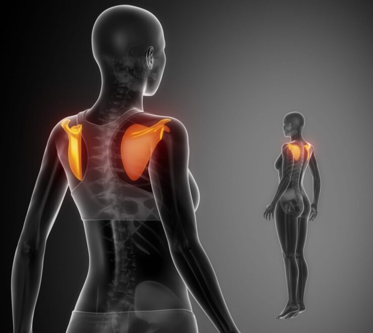 Deltoid Muscle Pain When Sleeping: Causes and Solutions - Missoula News